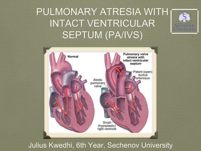 Patent Ductus Arteriosus (PDA) Echocardiographic Assessment: Anatomy ...