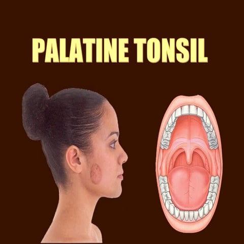 Palatine tonsil | PPT