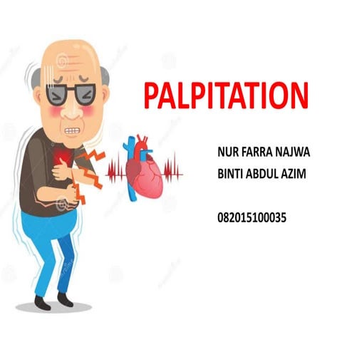 Palpitation | PPTX | Heart and Cardiovascular Diseases | Diseases and ...