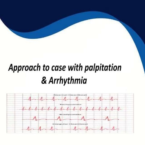 Palpitation & Arrhythmia .pptx
