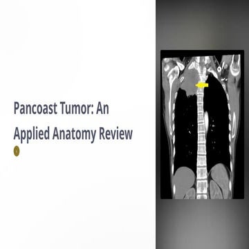 Pancoast-Tumor-An-Applied-Anatomy-Review.pptx