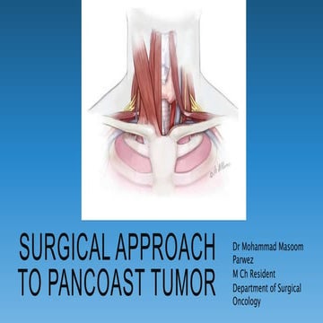 pancoast tumor.pptx