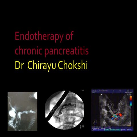 Endotherapy in Chronic Pancreatitis | PPTX