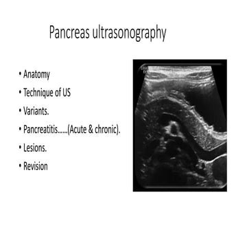 pancrease ppt.pptx