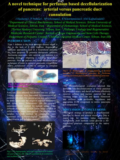 Pfizer poster A1 | PPTX | Digestive Disorders | Diseases and Conditions