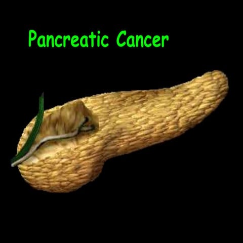 Pancreatic Cancer.ppt | Digestive Disorders | Diseases and Conditions