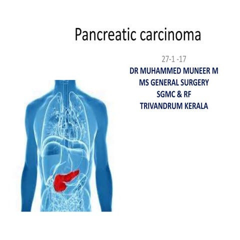 Pancreatic carcinoma dr mnr | PPT