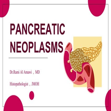 PANCREATIC NEOPLASM HISTOPATHOLOGY .pptx