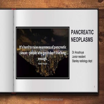 Pancreatic neoplasms | PPTX