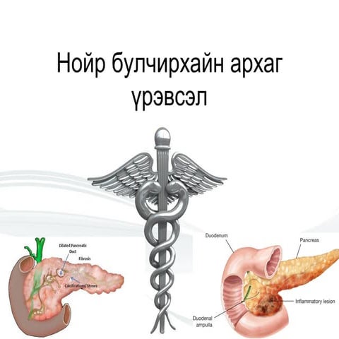 нойр булчирхай