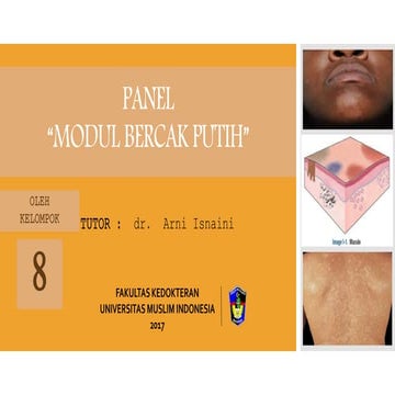 PANEL MODUL BERCAK PUTIH BLOK TROPIS FAKULTAS KEDOKTERAN UMI | PPT