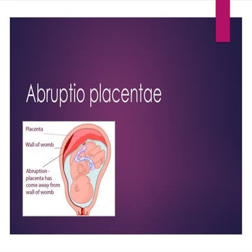 Pa Placental Abruption Gynecology Pptx