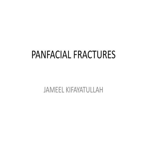 Panfacial fractures | PPTX