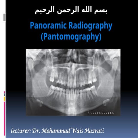 Anatomic landmarks seen in a IOPA | PPTX