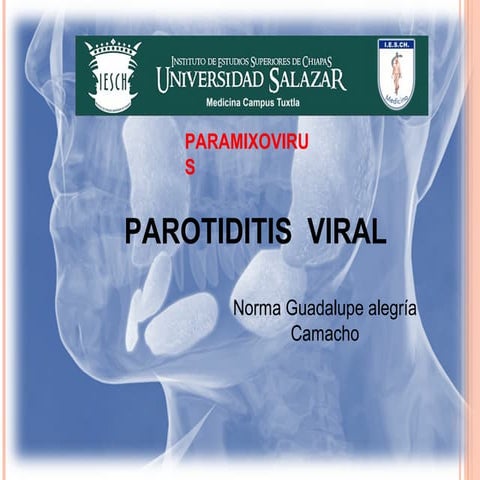 Parotiditis viral | PPT
