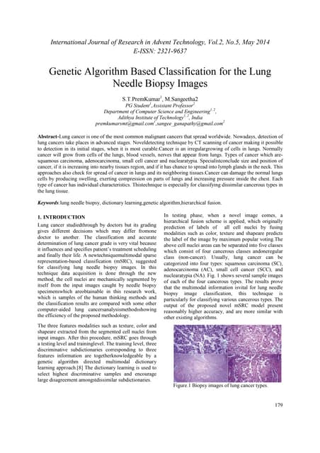 Classification Techniques Using Gray Level Co Occurrence Matrix Features For The Detection Of