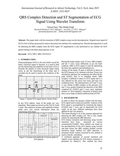 Iot based ECG monitoring system using node mcu | PPTX