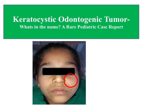 CARNOY’S SOLUTION AS A SURGICAL MEDICAMENT IN THE TREATMENT OF ...