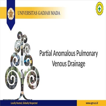 papvd partial anomalous pulmonary vein drainage.pptx