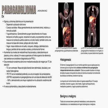 PARAGANGLIOMA - ORIGEN DE SU DESARROLLO - DIAGNOSTICO - MACROSPCOPIA ...