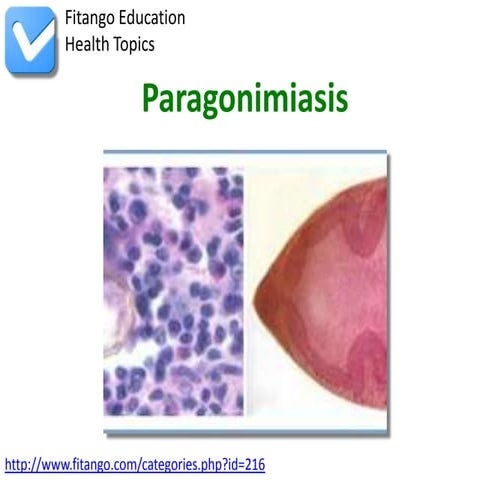 Paragonimiasis | PPTX