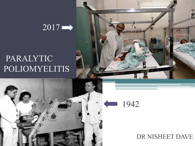 Poliomyelitis and its management | PPTX