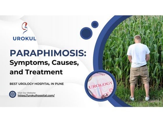 Urologic Cancer: Symptoms & Causes | PPT