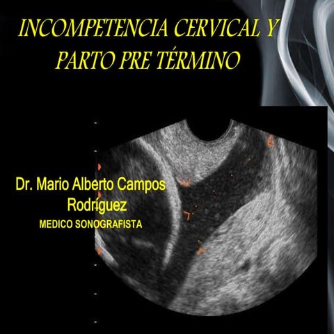 Incompetencia Cervical y Parto Pretérmino | PPTX