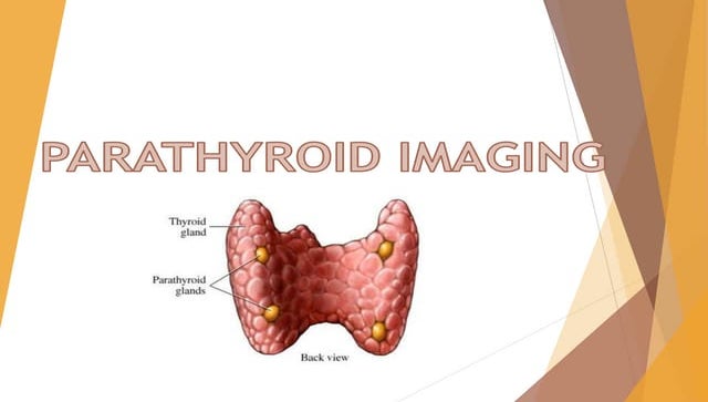 Parathyroid Diagram