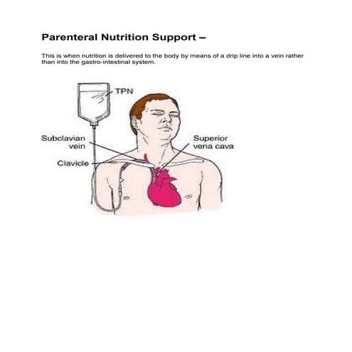 Parenteral nutrition support picture | PDF