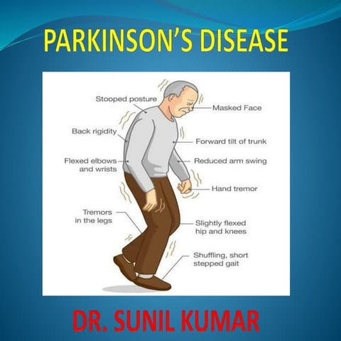 Parkinson | PPT