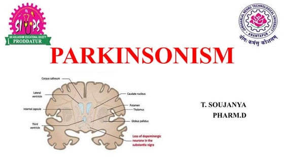 pathophysiology of parkinsons disease | PDF | Physical Therapy | Wellness