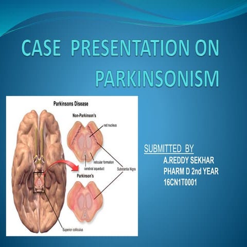 case presentation of Parkinson's disease | PPT