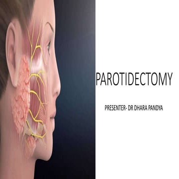 PAROTIDECTOMY | PPTX