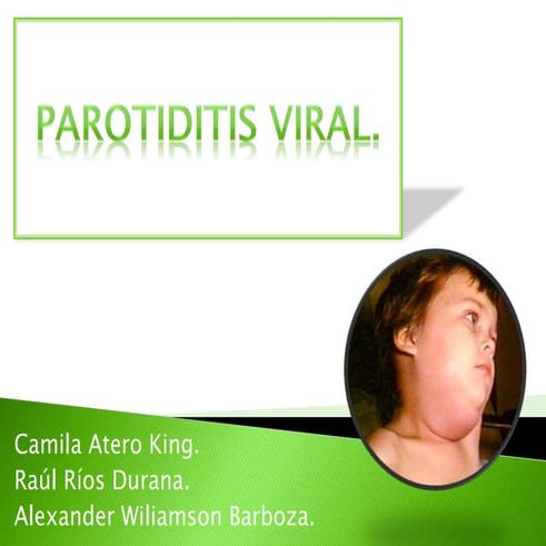 Parotiditis viral | PPTX