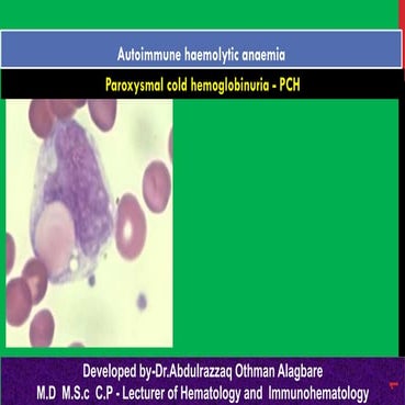 Paroxysmal cold hemoglobinuria -PCH | PDF
