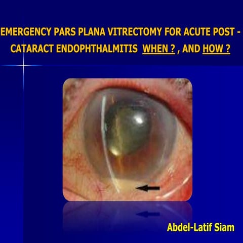 EMERGENCY PARS PLANA VITRECTOMY FOR ACUTE POST - CATARACT ...