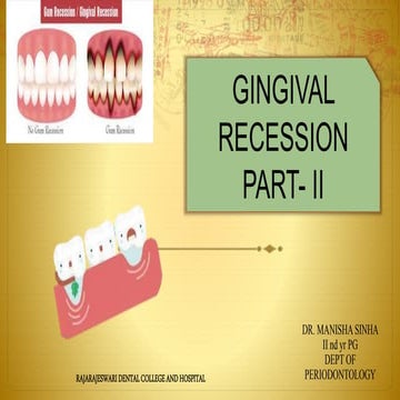 Free gingival graft | PPTX