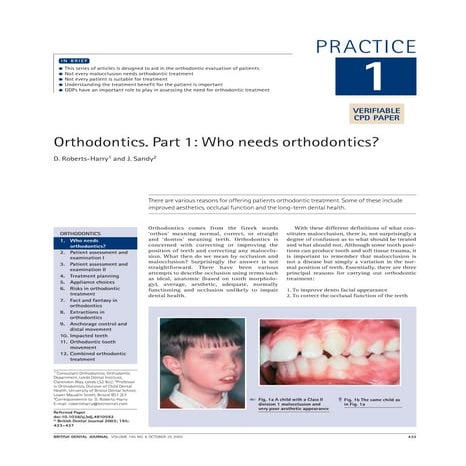 Introduction to orthodontics | PPT