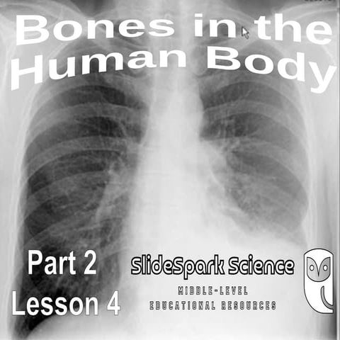 Common Bones in the Human Body Lesson, Middle School Lesson about Bones on the Human Body ...