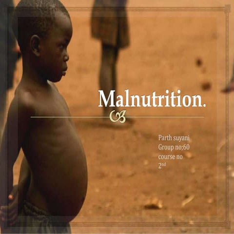 malnutrition | PPTX | Children\'s Health | Healthy Living