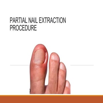 PARTIAL NAIL EXTRACTION PROCEDURE.pptx