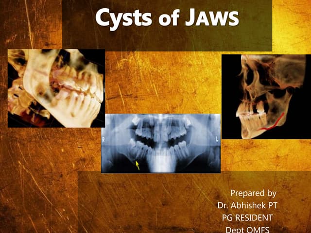 gorlin cyst or calcifying odontogenic cyst | PPTX