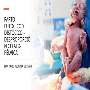 Comprehensive Overview of Eutocic and Dystocic Labor with Cephalopelvic ...