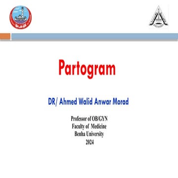 Partogram( Dr Ahmed Walid Anwar Morad) professor of Ob & Gyn, Benha Faculty of Medecine | PPT