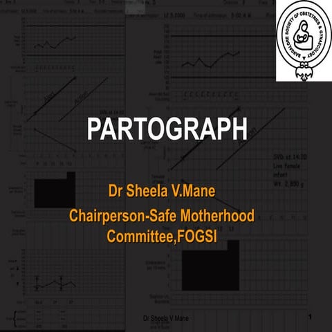 partograph guide through with images included | PPT