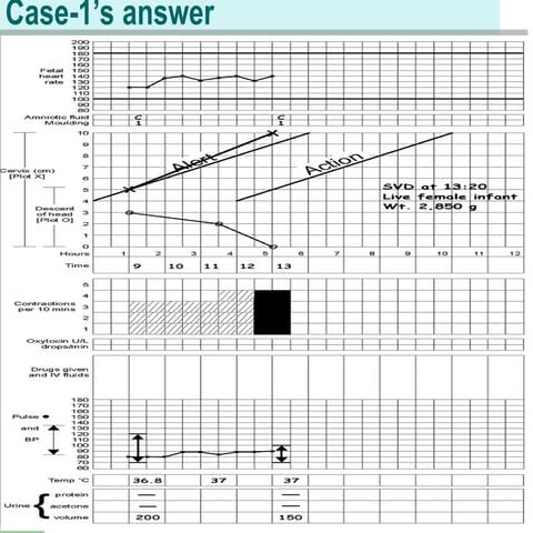 PARTOGRAPH & ABNORMAL LABOUR PATTERNS-2021.ppt
