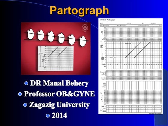 Partogram | PPT | Pregnancy | Reproductive Health