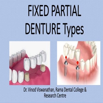 1/2 Fixed Partial Dentures (FPD) Introduction & Basics @ Faryal | PDF