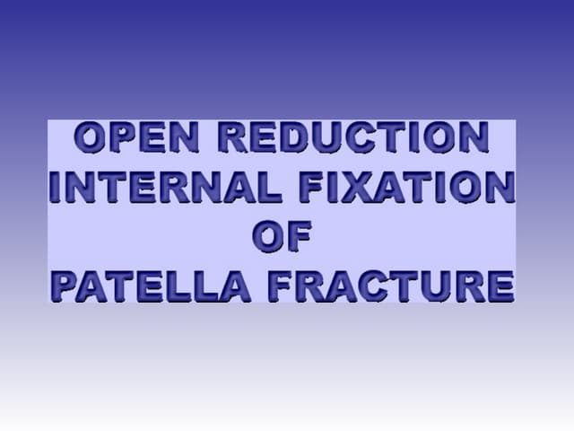 LARS ACJ Surgical Technique Corin Lennard Funk | PDF